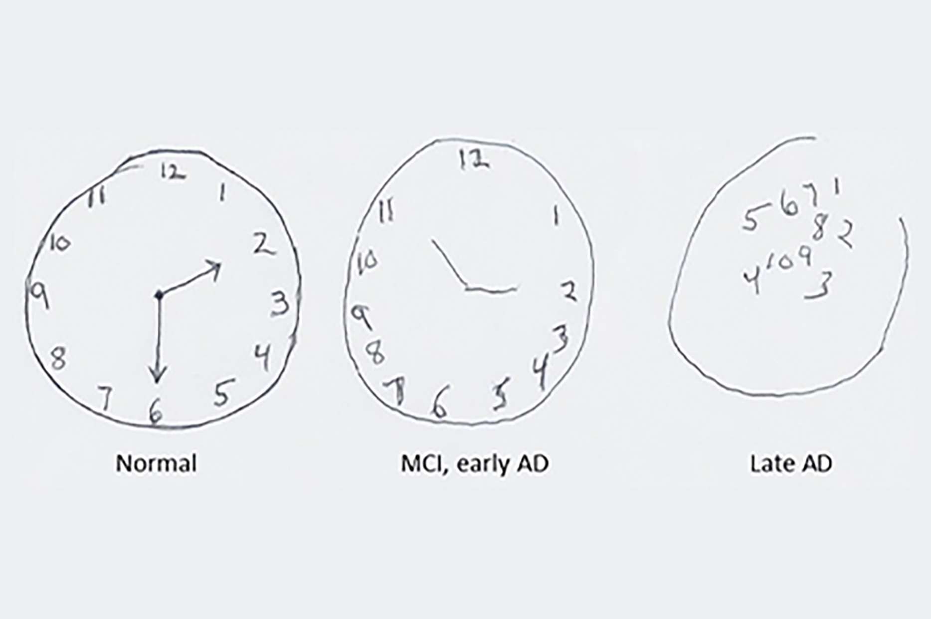 History of the Clock Drawing Test and the Linus Health Platform