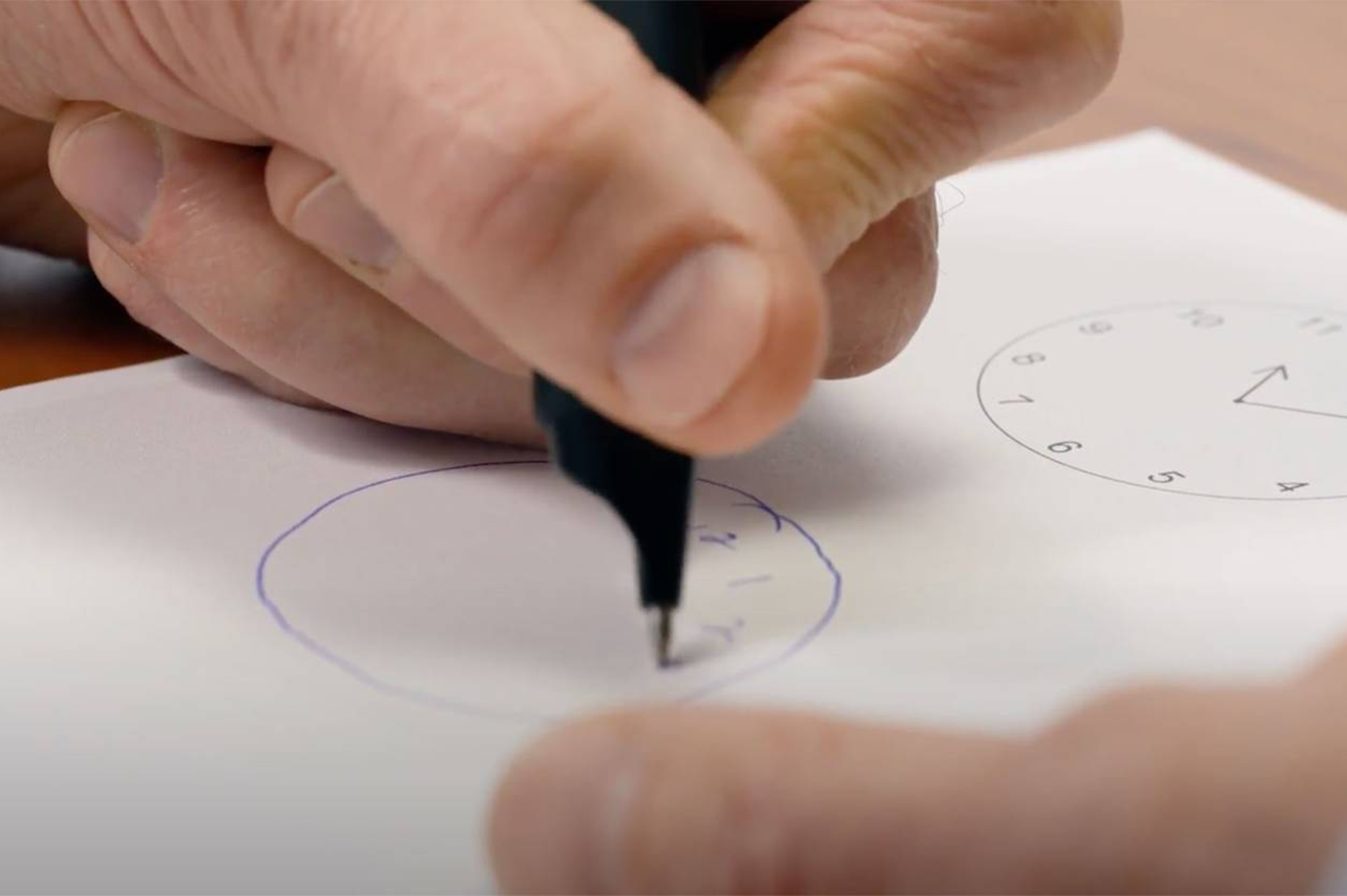 History of the Clock Drawing Test and the Linus Health Platform